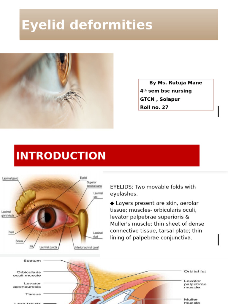 Eyelid Deformities - Adult Health Nursing | PDF | Diseases And Disorders | Medical Specialties