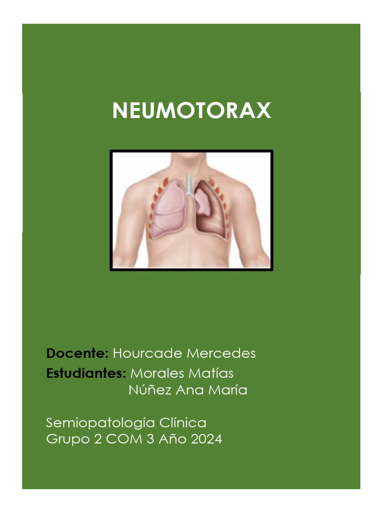 Neumotórax: Definición y Clasificación | PDF | Pulmón | Enfermedades y ...