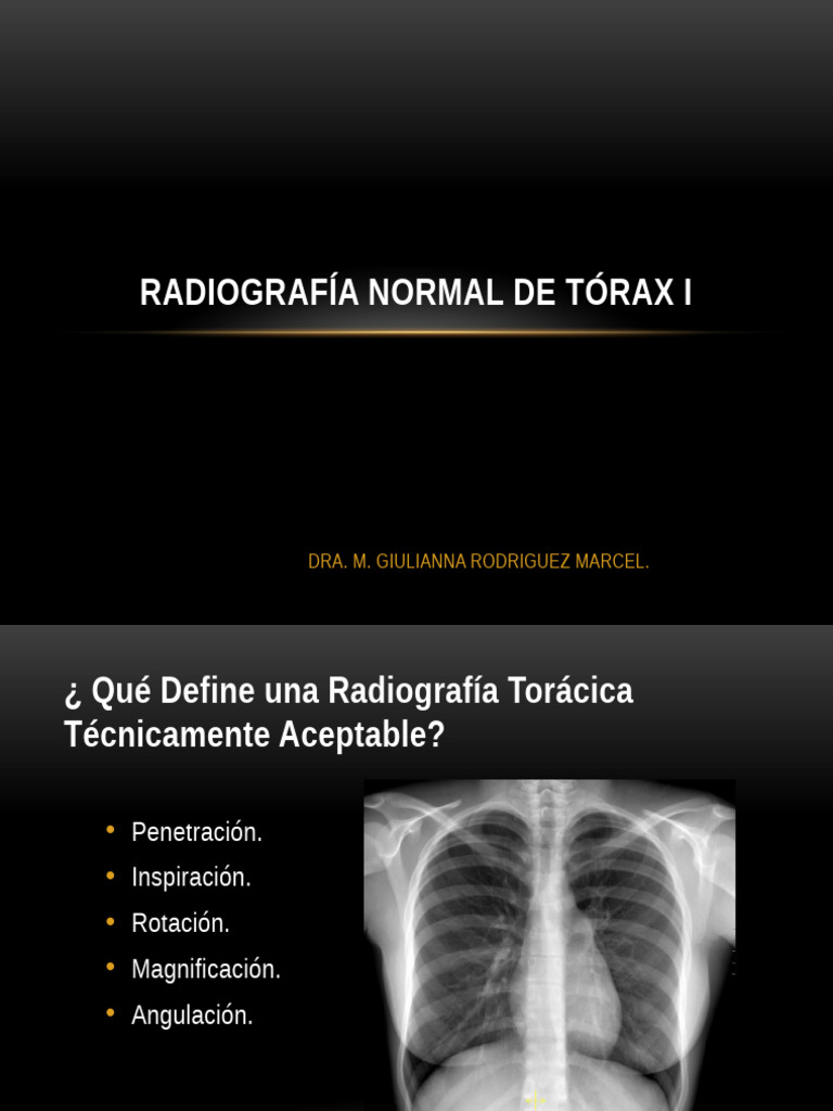 Clase Teorã - A (G) 2a-Tã - Rax Normal | PDF | Corazón | Tórax