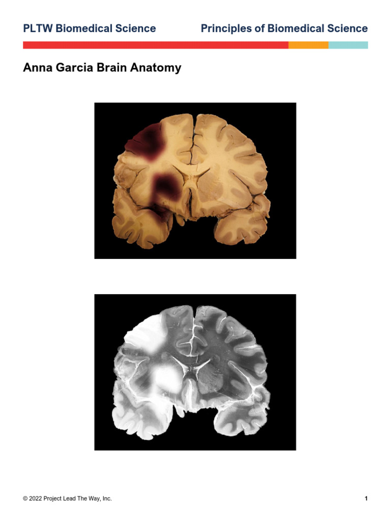 PBS 124 BrainAnatomy of Anna Garcia | PDF | Self-Improvement