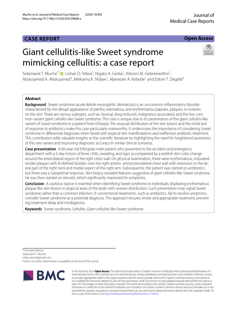 Giant Cellulitis Like Sweet Syndrome Mimicking Cellulitis Case Report | PDF | Creative Commons ...