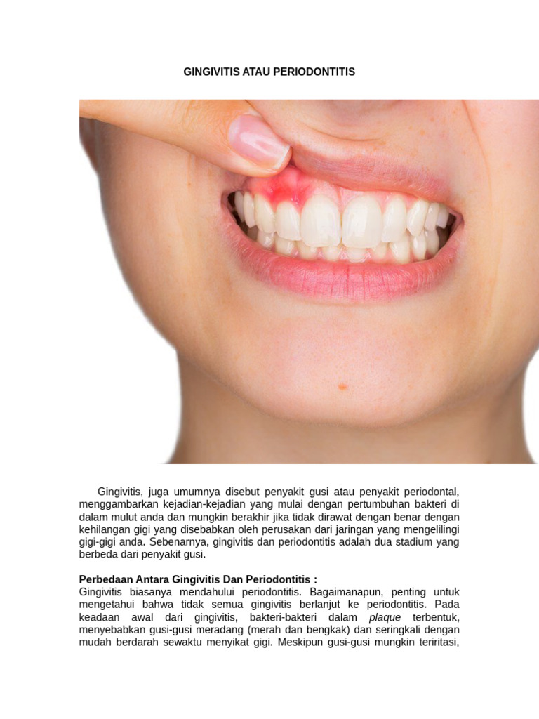 Gingivitis Atau Periodontitis | PDF | Kesehatan Holistik | Sains & Matematika