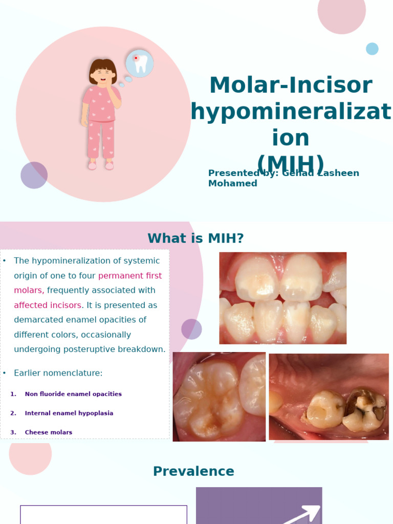 Molar Incisor Hypomineralization | PDF | Tooth Enamel | Diseases And ...