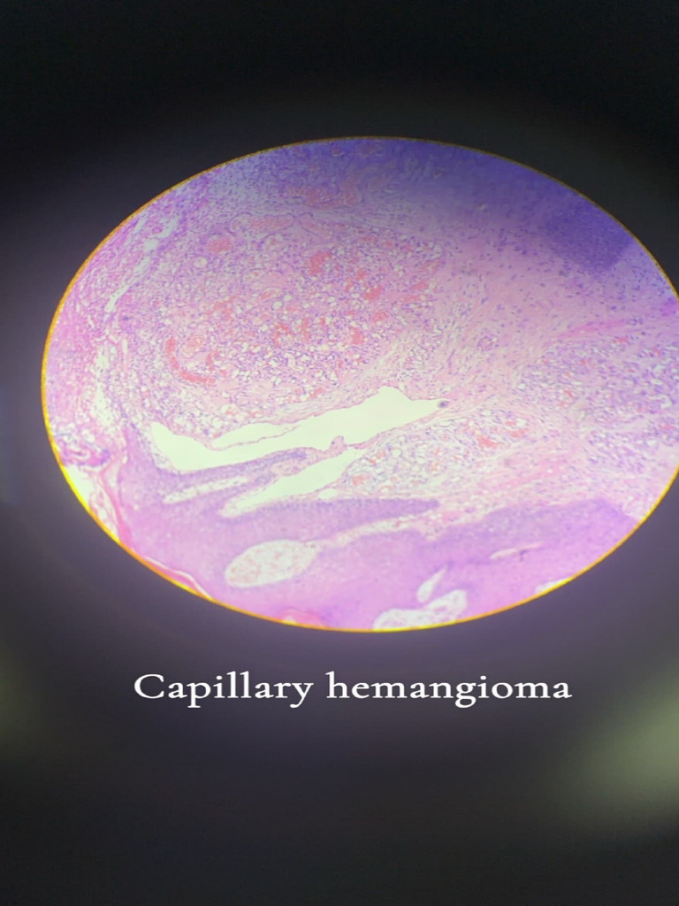 Histopathology | PDF