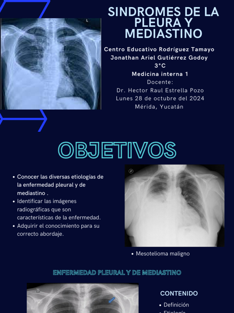Sindromes de La Pleura y Mediastino - 20241026 - 204523 - 0000 | PDF | Medicina CLINICA ...
