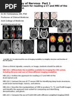 Understanding Midline Shift on CT | PDF | Ct Scan | Cerebrospinal Fluid
