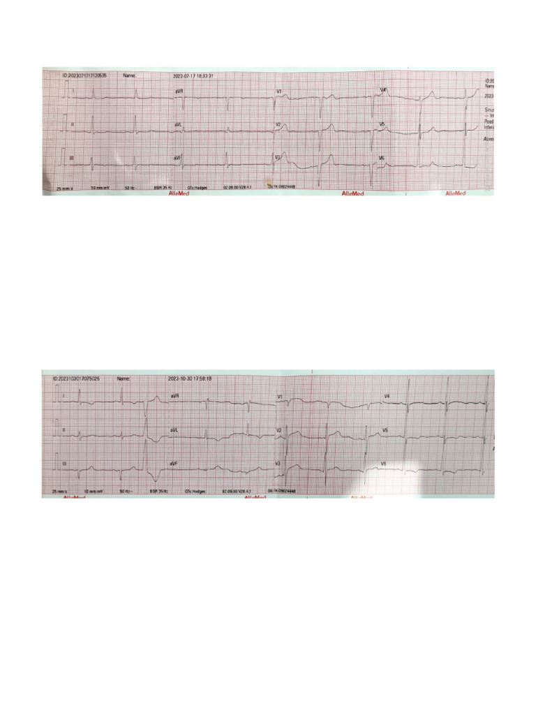 PR Ekg Format | PDF