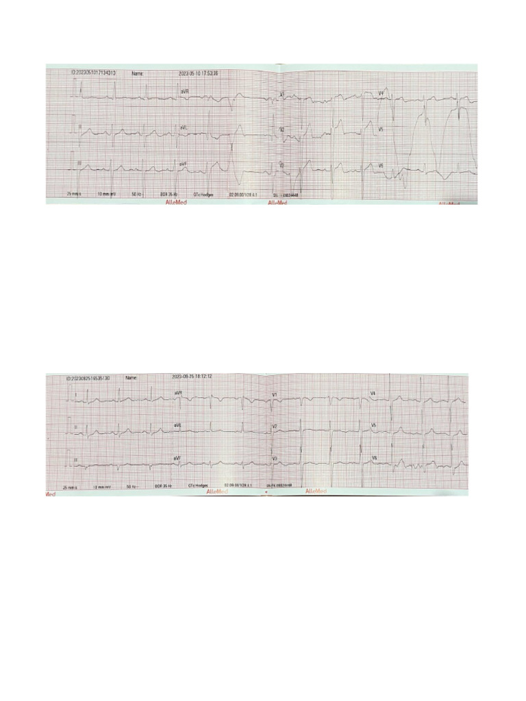 PR EKG Habib Siap Print | PDF