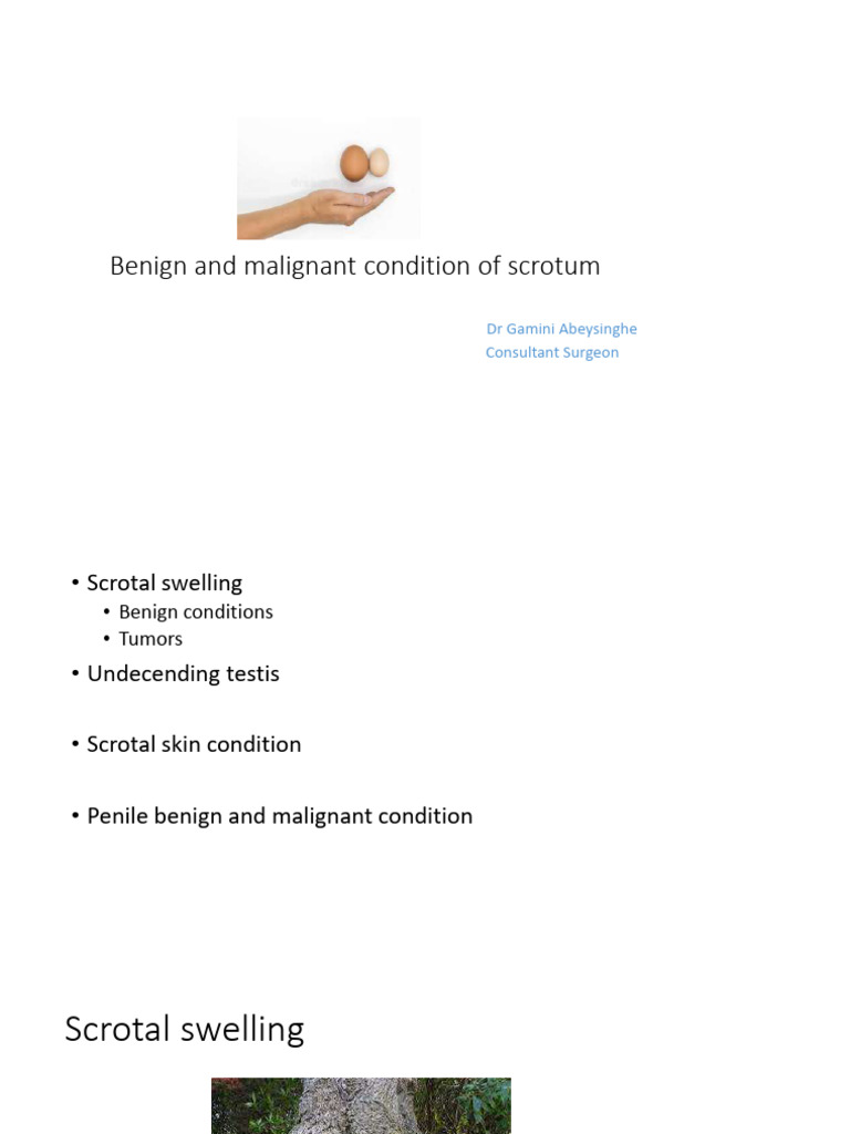 Scrotal Conditions: Benign & Malignant Overview | PDF | Diseases And ...