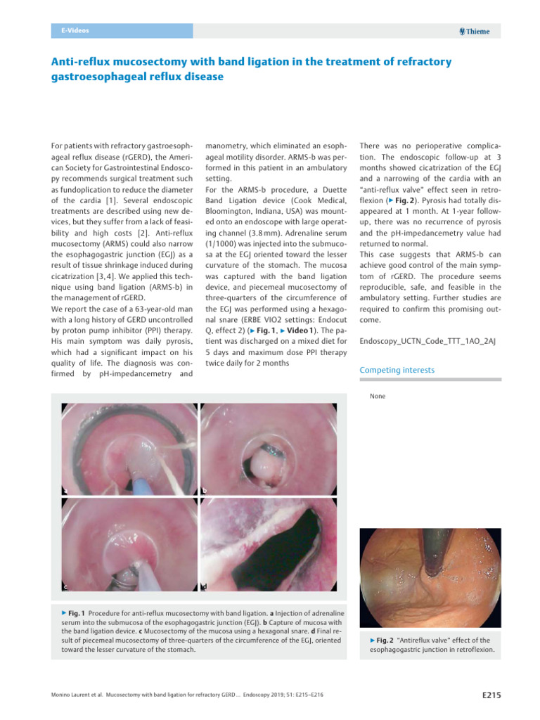 Effect of Band Ligation TTT of Gerd | PDF | Gastroesophageal Reflux ...