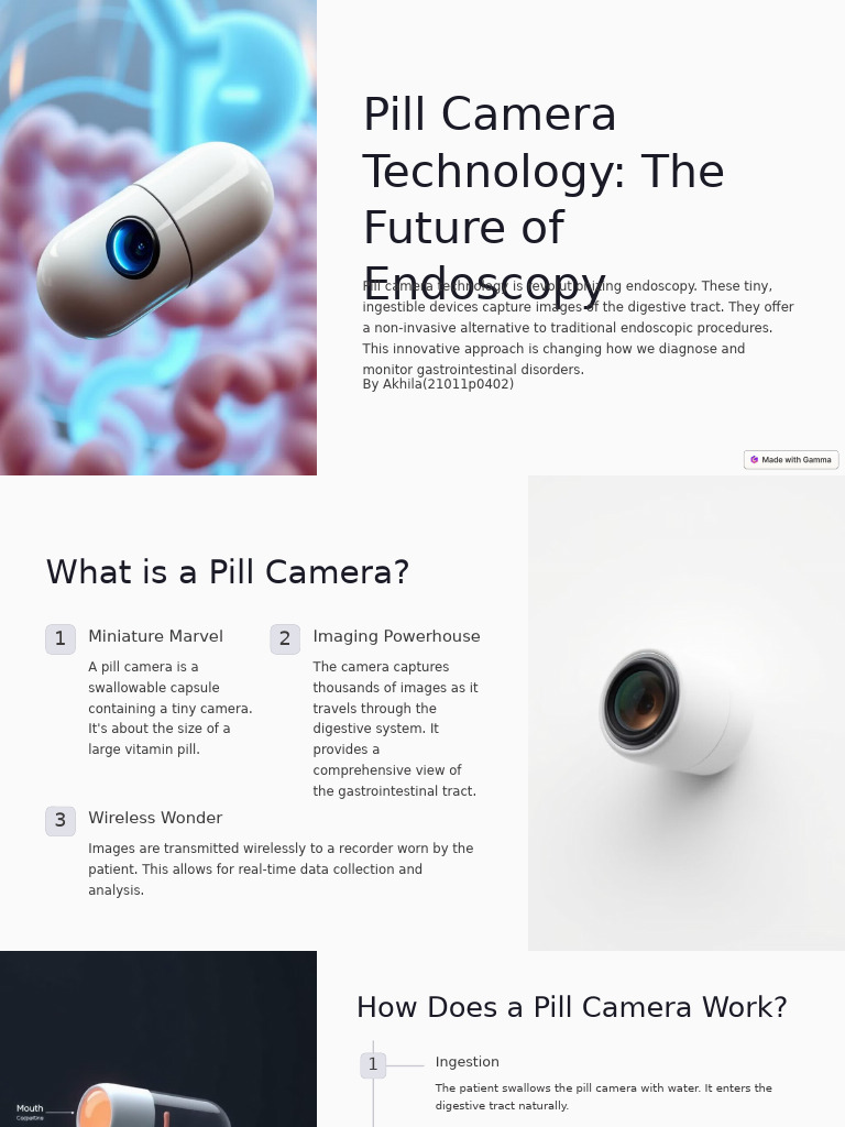 Pill Camera Technology The Future of Endos | PDF | Gastroenterology ...