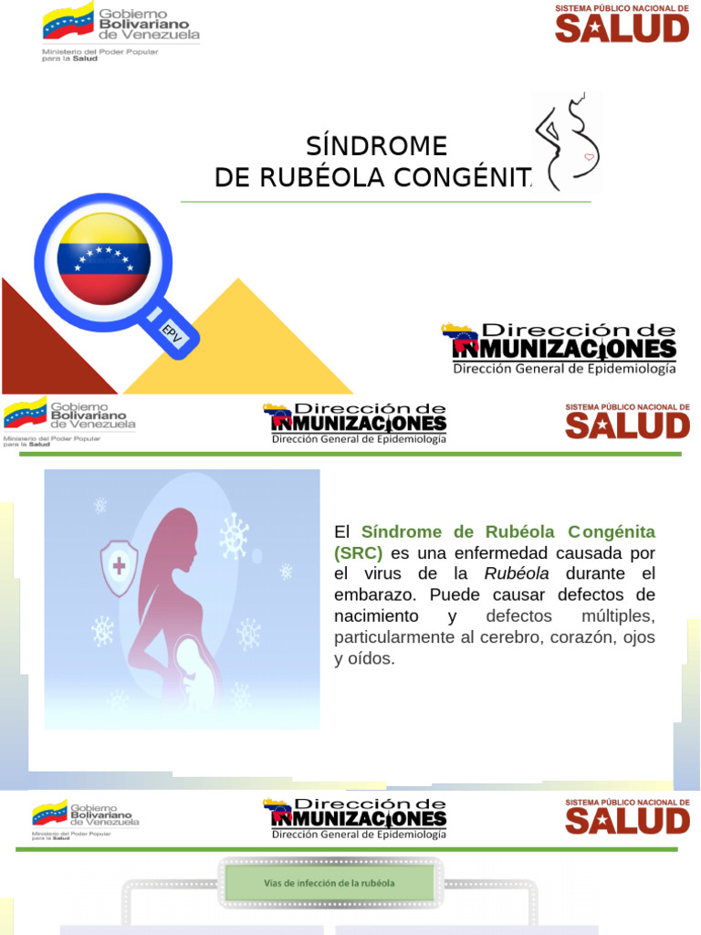 Guía del Síndrome de Rubéola Congénita | PDF | Salud pública | Inmunología