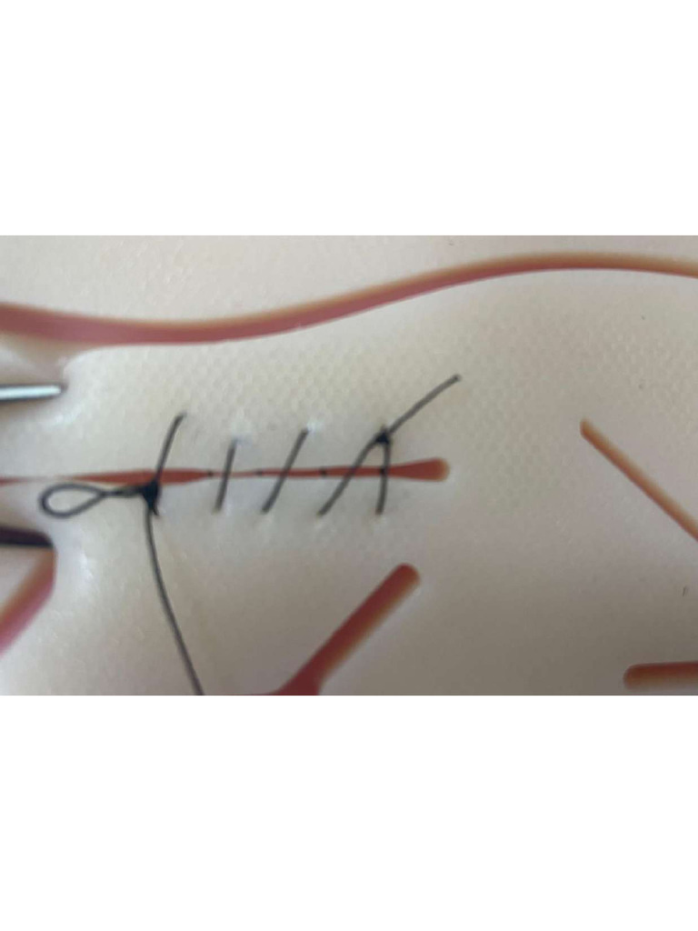 Sutura Simple Continua - Aguilar Castro Luis Sebastián | PDF