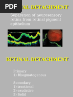 Understanding White Without Pressure (WWOP) | PDF | Vision | Ophthalmology