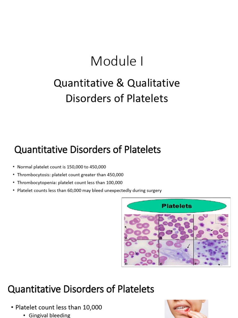 Quantitative & Qualitative Disorders of Platelets | PDF | Platelet ...