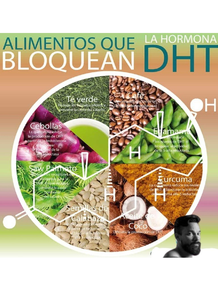 DHT Caida Cabello | PDF