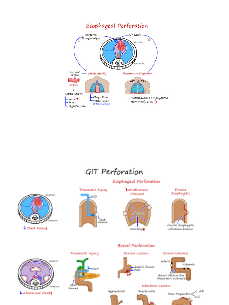 20 - Gastrointestinal Perforation (Illustrations Key) | PDF ...
