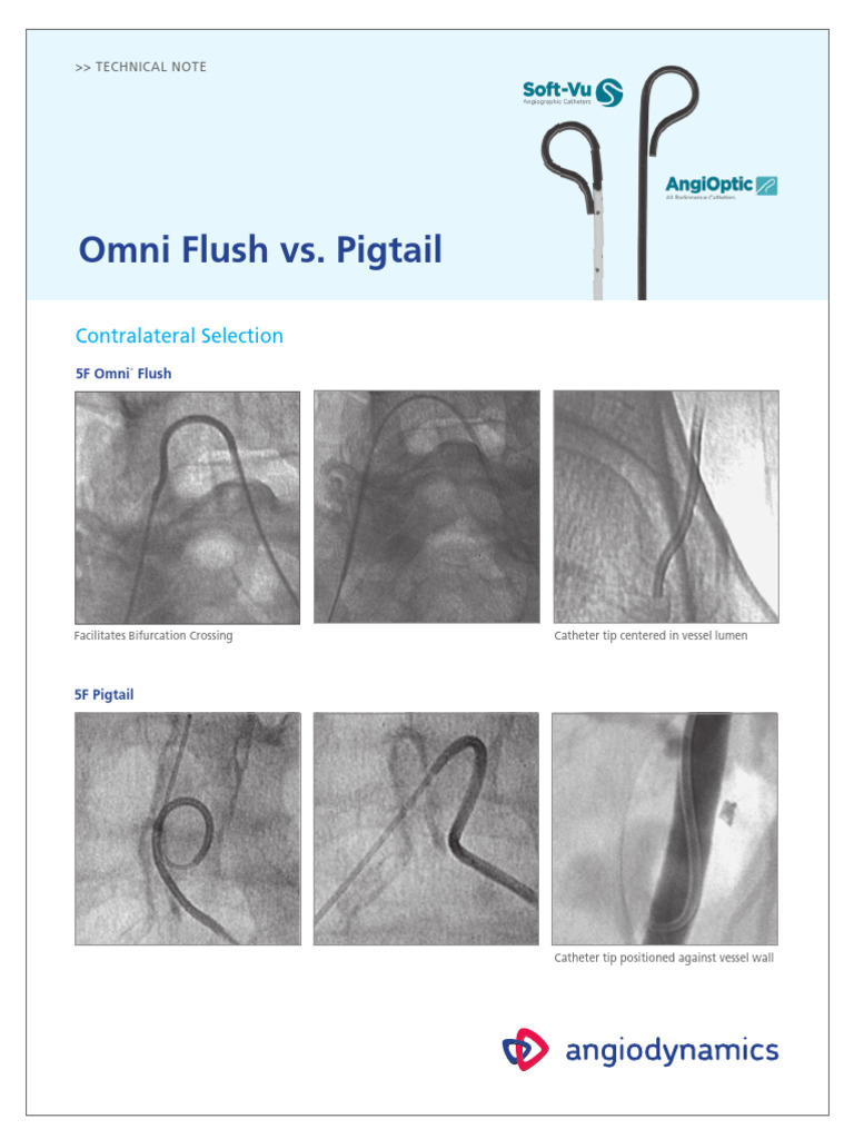 Omni Flush vs. Pigtail Catheters Explained | PDF | Angiography | Catheter