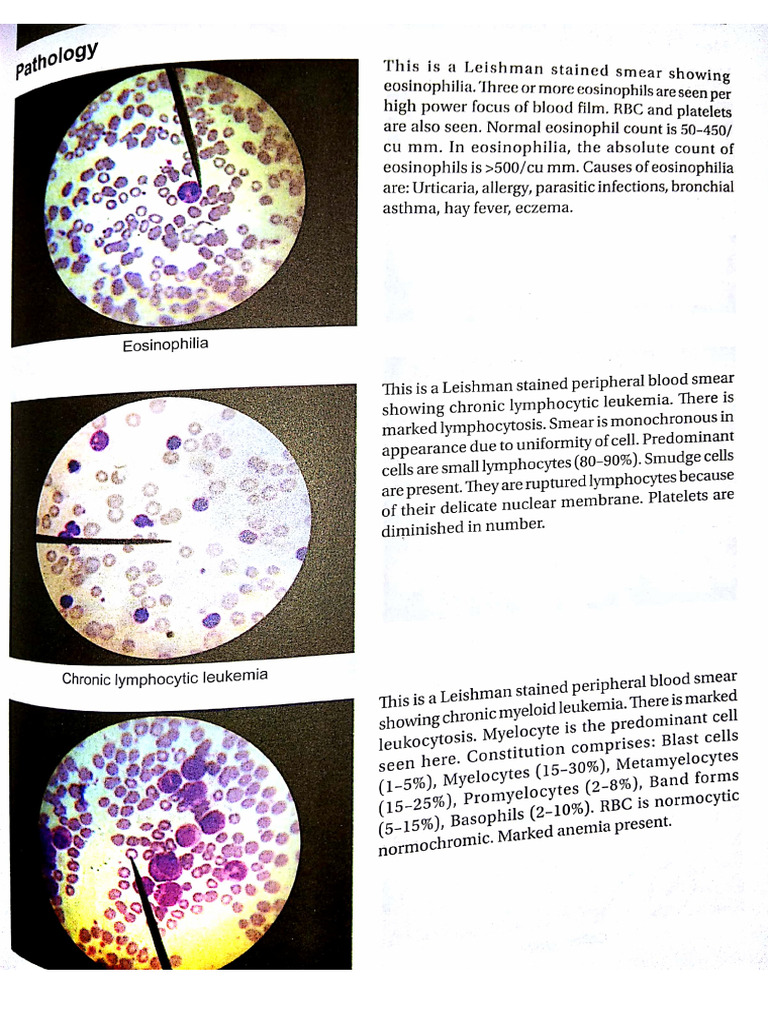 Tumor and Non Tumor Slides | PDF