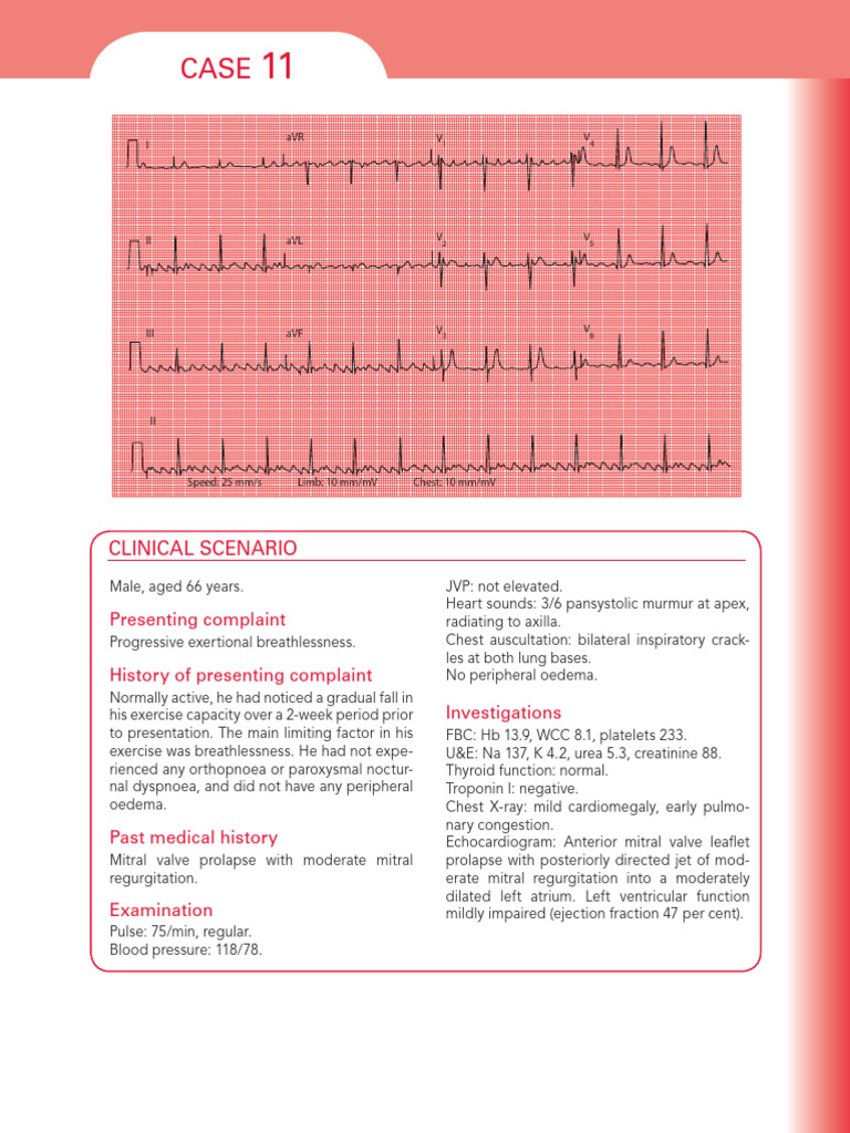 b16922-12 | PDF | Atrium (Heart) | Cardiovascular Physiology