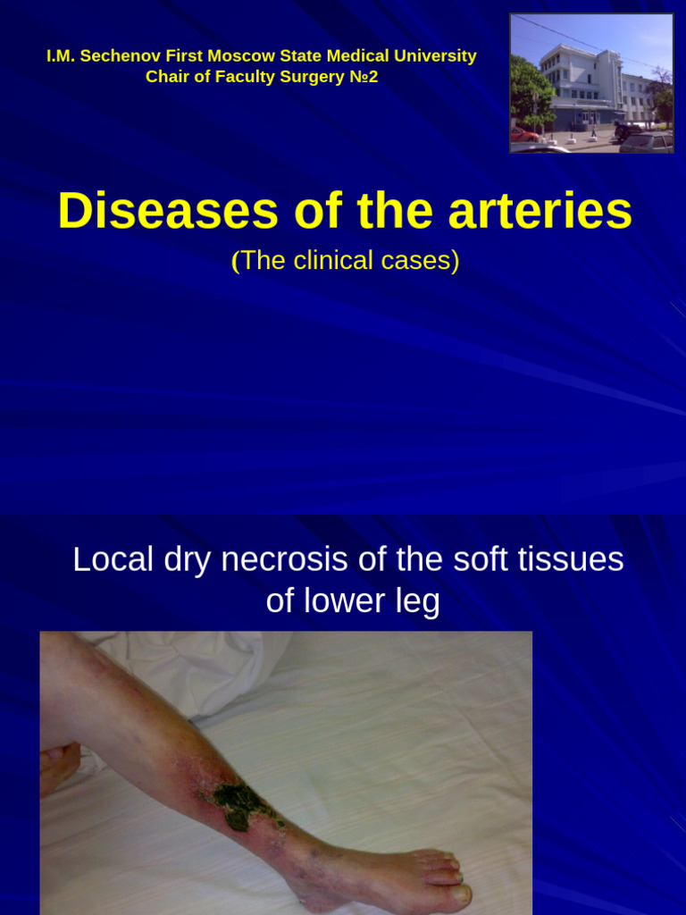 ARTERIES - Clinical Cases | PDF