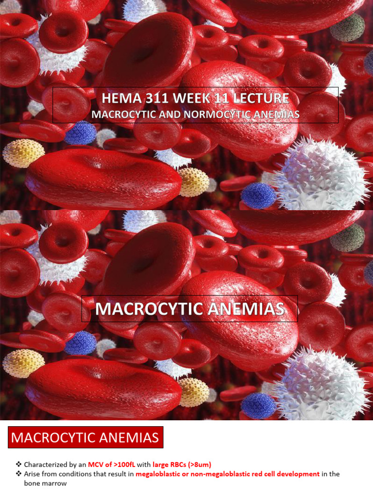 MACROCYTIC AND NORMOCYTIC ANEMIAS | PDF | Anemia | Vitamin B12