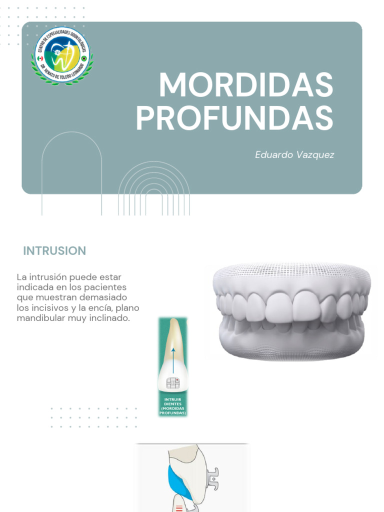 Mordidas Profundas | PDF | Diente | Boca