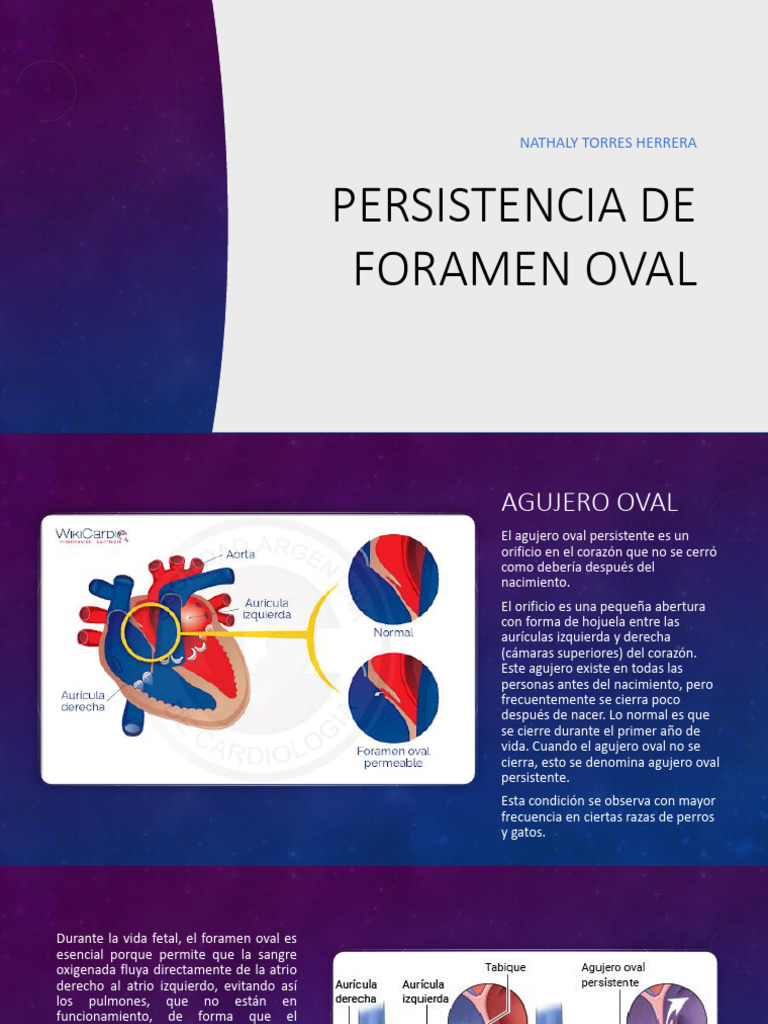Persistencia de foramen oval | PDF | Feto | Corazón