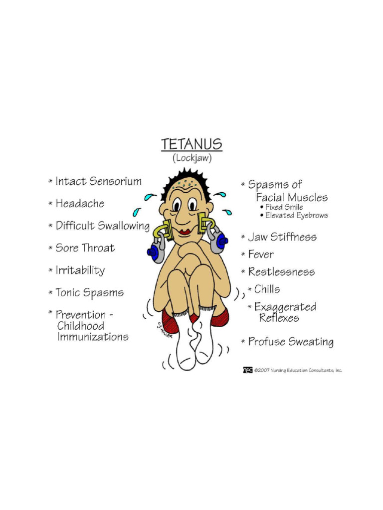 Tetanus | PDF