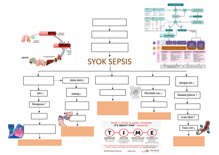 Gadar Pathway Sepsis | PDF