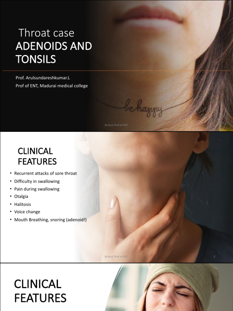 Tonsils and Adenoids UG | PDF | Medical Specialties | Diseases And Disorders