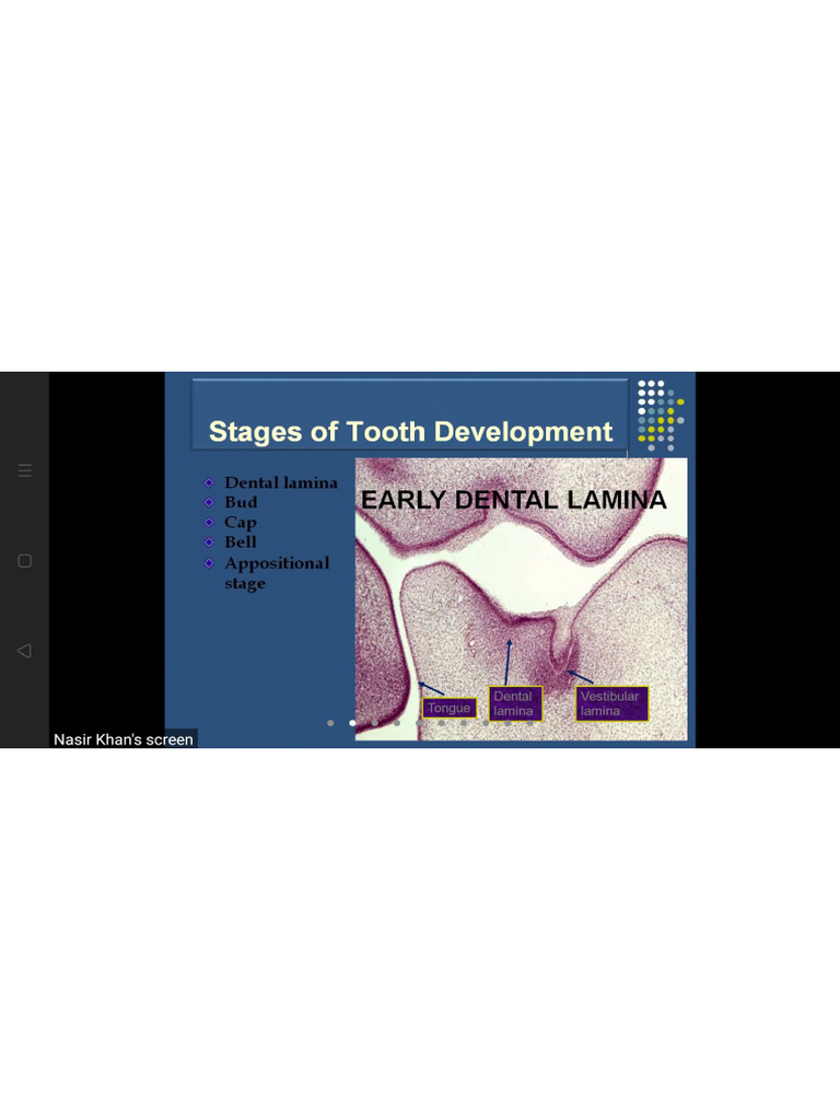 Stages of Tooth Development | PDF