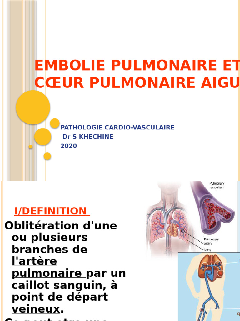 Embolie pulmonaire : définition et traitement | PDF | Maladies et ...