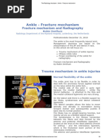 The Radiology Assistant - Ankle Fracture - Weber and Lauge-Hansen ...