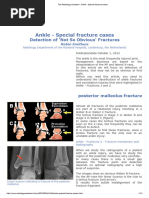 The Radiology Assistant - Ankle Fracture - Weber and Lauge-Hansen ...