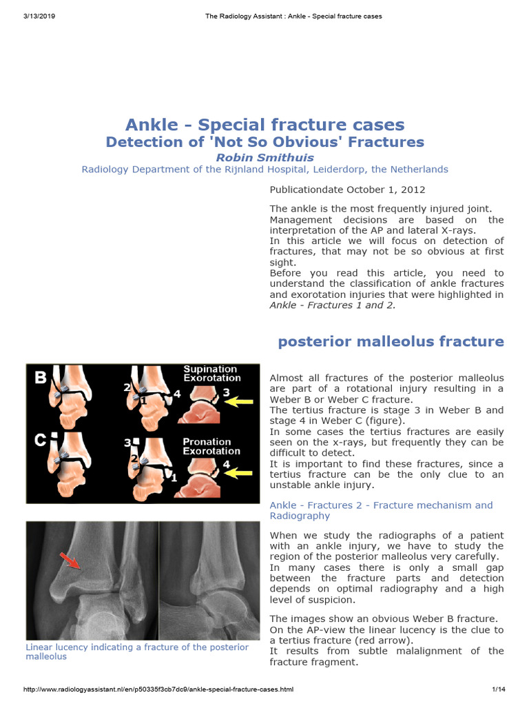 The Radiology Assistant - Ankle - Special Fracture Cases | PDF | Ankle ...