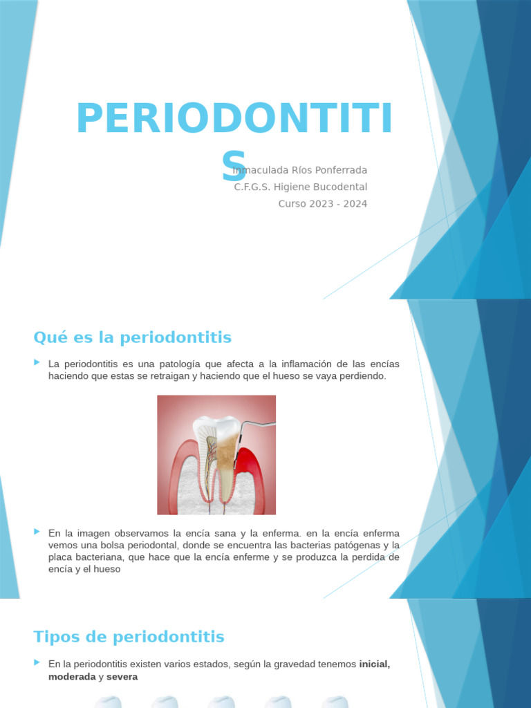 PERIODONTITIS | PDF | Enfermedades y trastornos | Especialidades Medicas
