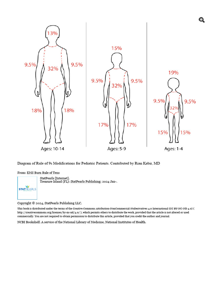 [Figure, Diagram of Rule of 9s Modifications for Pediatric Patients ...