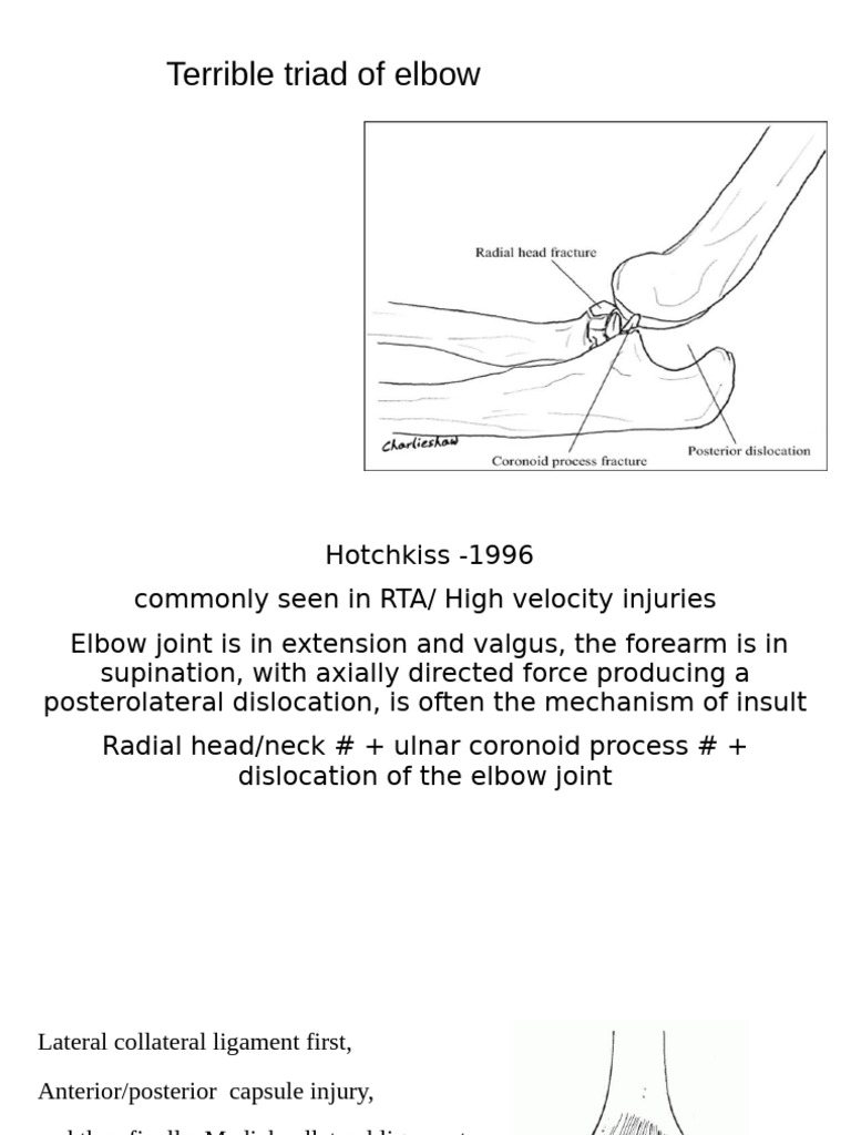 Terrible Triad of Elbow | PDF | Elbow | Injury