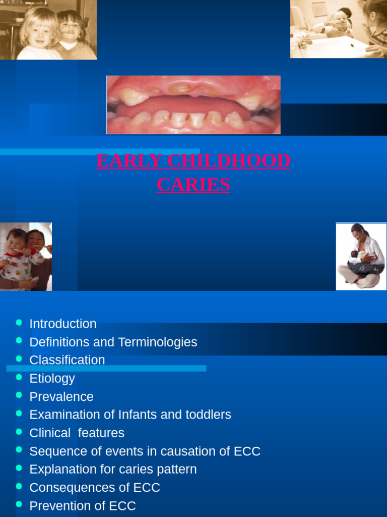 Early Childhood Caries: Definitions & Management | PDF | Human Tooth ...