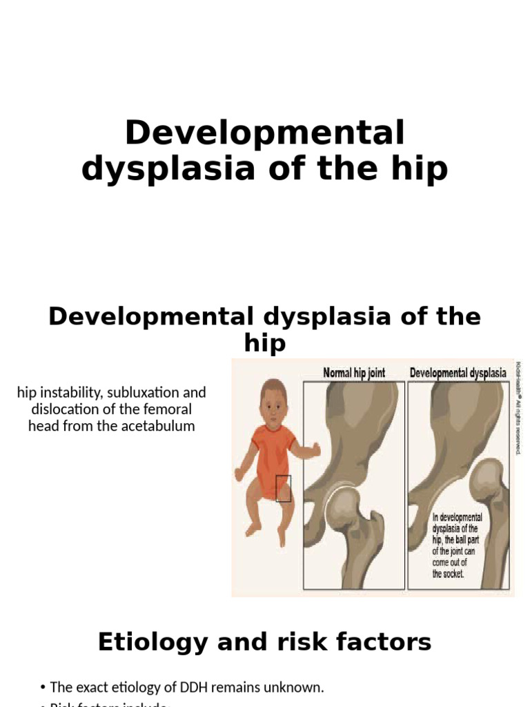 Developmental Dysplasia of Hip | PDF | Musculoskeletal Disorders ...