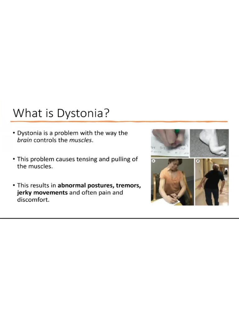 Dystonia | PDF