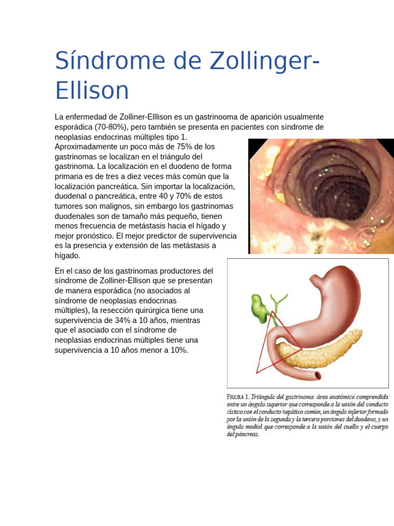 Síndrome de Zollinger Ellison | PDF