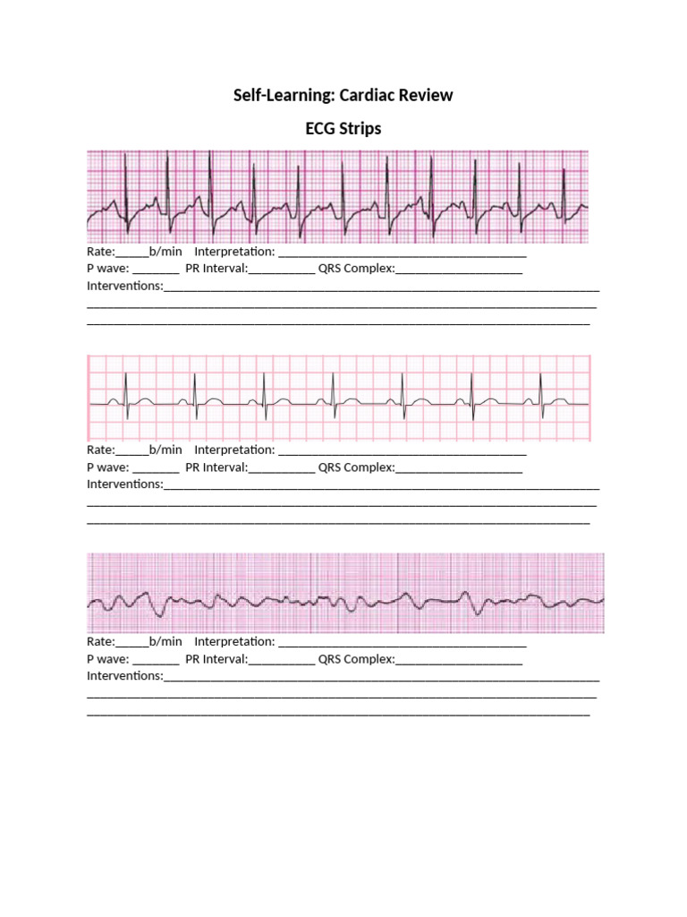 ECG_Strips_KPJAN2022 | PDF | Electrocardiography | Cardiology