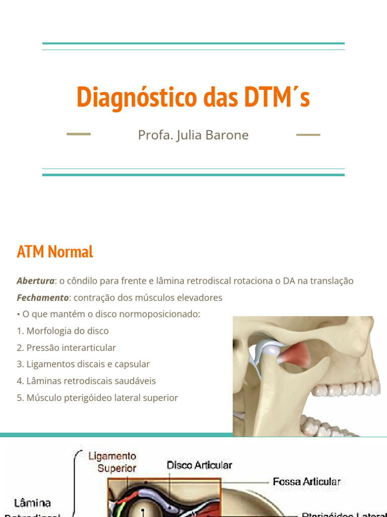 Diagnóstico e Tratamento da DTM | PDF | Dor | Osteoartrite