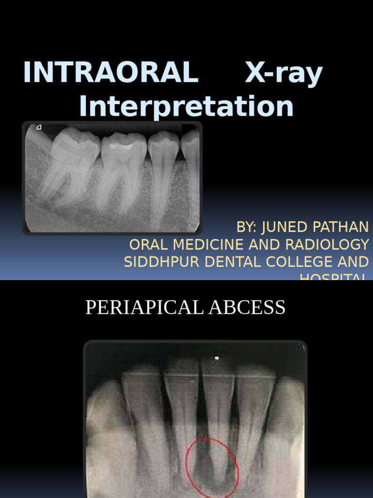 Juned Sir Lectire Iopa Interpretation | PDF