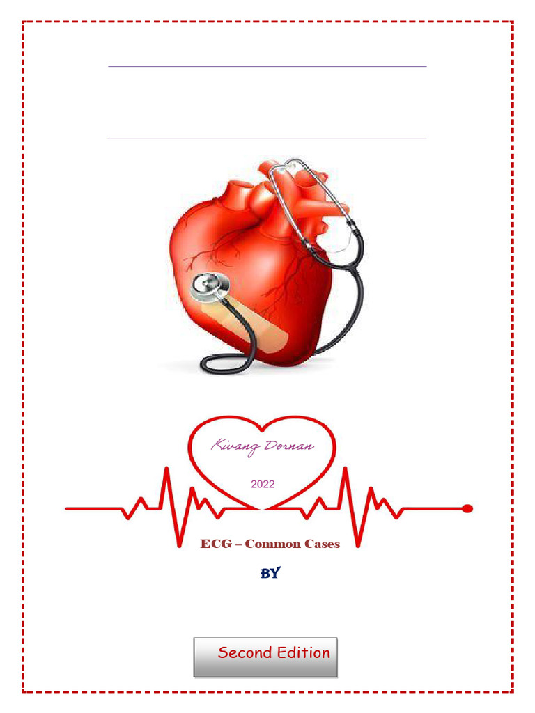 ECG Interpretation and Common Cases Guide | PDF | Myocardial Infarction ...