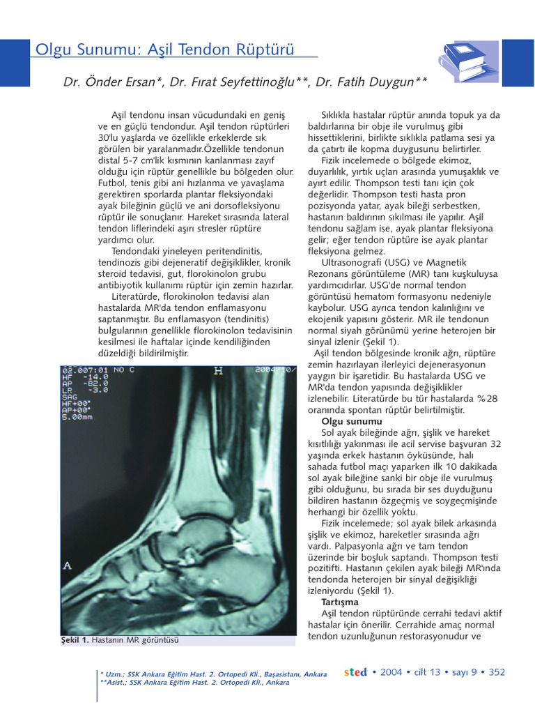 Olgu Sunumu Asil Tendon Rüptürü | PDF