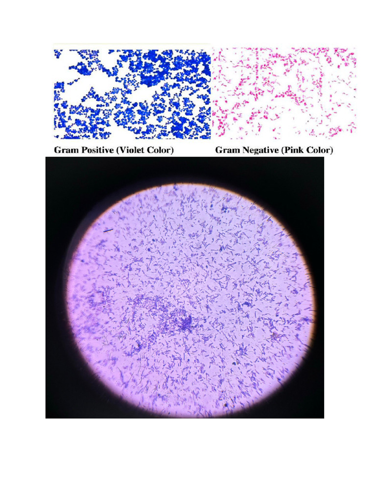 Gram Staining | PDF