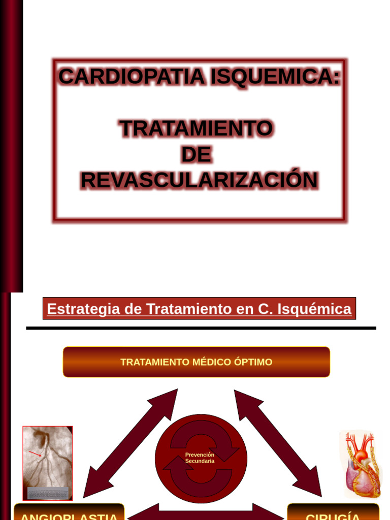 5-Resumen Revasc | PDF | Isquemia | Especialidades Medicas